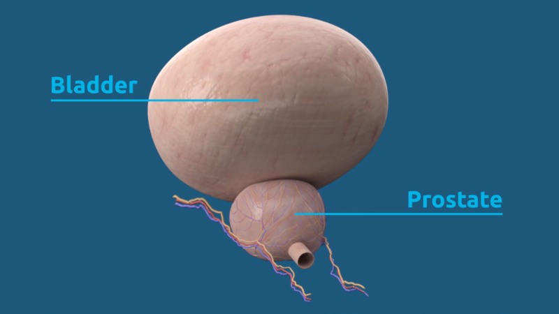 How Water Vapor Therapy Works - Francis Medical